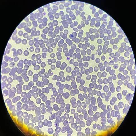 Giant Platelet Object Detection Dataset By Siavash