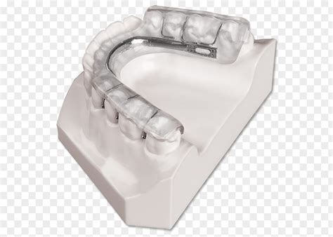 Mandibular Advancement Splints Splint Dentistry Temporomandibular Joint