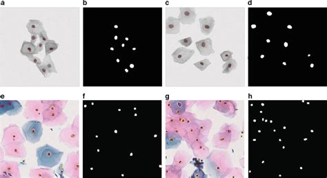 Nucleus Segmentation On ISBI Dataset Above Ae And BSMMU Download Scientific Diagram