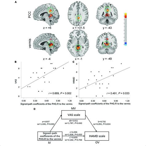 Brain Regions Exhibiting Enhanced Functional Connectivity Fc With Download Scientific