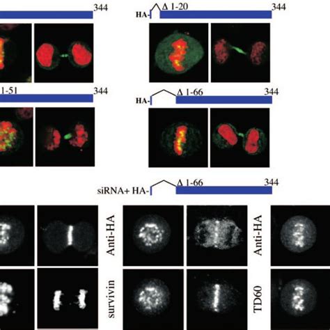 Intracellular Localization Of N Terminal Deletions Of Aurora B A