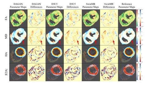 Diffusion Parameter Maps Of The Reconstruction Results Af ×4 And The Download Scientific