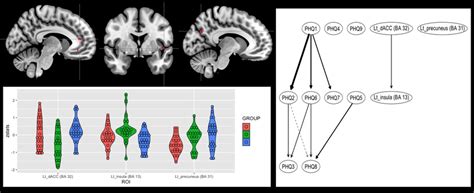 Between Group Differences Of Functional Brain Activation For Conflict Download Scientific