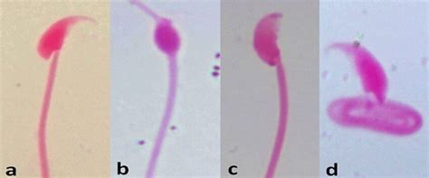 Sperm Abnormalities Showing A Control B Amorphous Head C Head