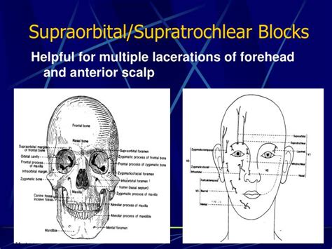 Ppt Nerve Blocks Powerpoint Presentation Id6088129