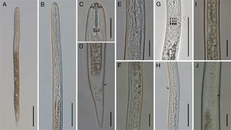 Light Micrographs Of Second Stage Juvenile Of H Microulae Sp N A