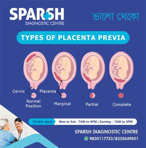Placenta Previa Sparsh Diagnostic Center