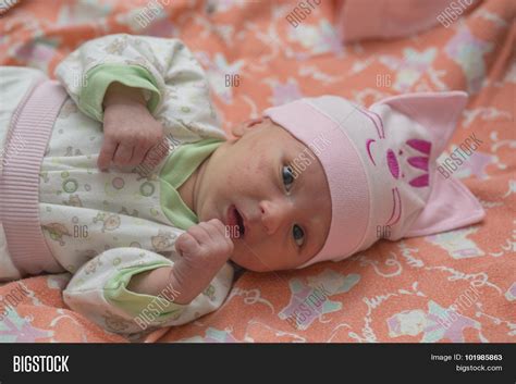 Hormonal Rash Newborn Image And Photo Free Trial Bigstock