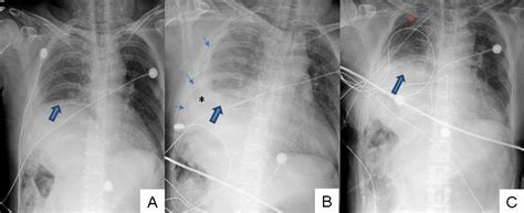 Southwest Journal Of Pulmonary Critical Care And Sleep Imaging