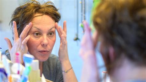 Pimples On Eyebrows Causes Treatment And Prevention