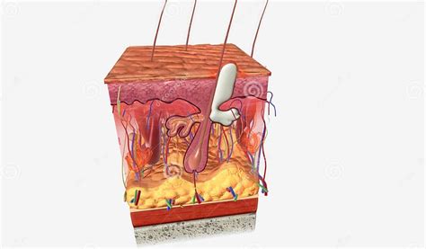Pyoderma Gangrenosum Stage Ii 3d Stock Illustration Illustration Of