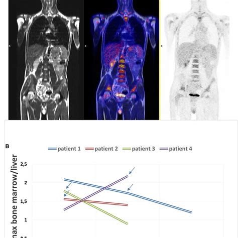 A Example Of An ¹⁸f Fluorodeoxyglucose ¹⁸f Fdg Positron Emission Download Scientific