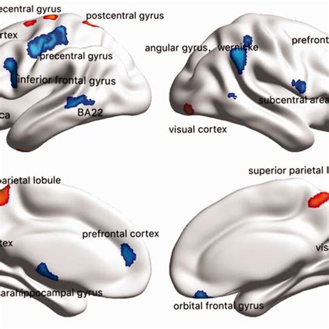 Global Functional Connectivity Density Alterations In Healthy