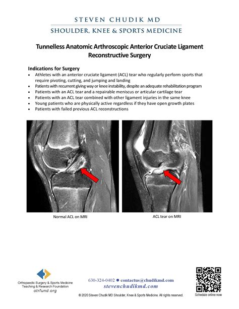 Knee Acl Reconstruction