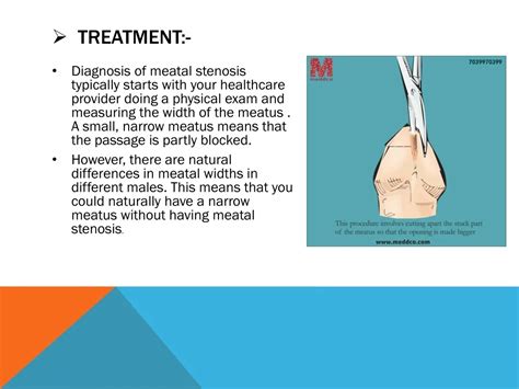Ppt Meatoplasty Surgery Powerpoint Presentation Free Download Id11246126