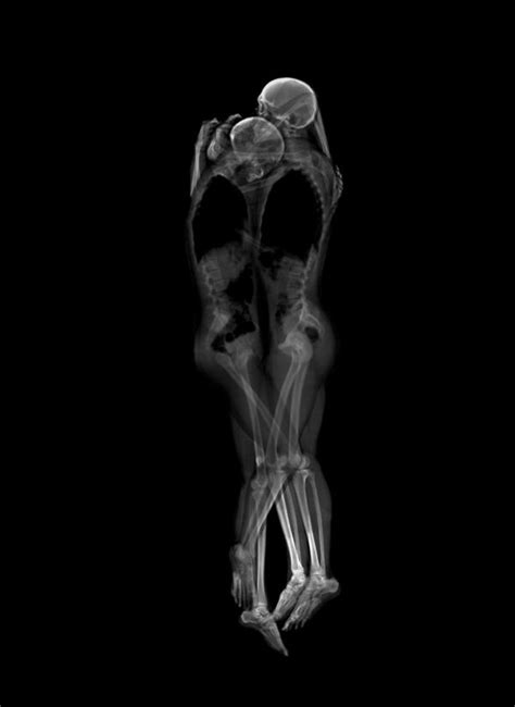 X Ray Portraits Of Couples Neatorama