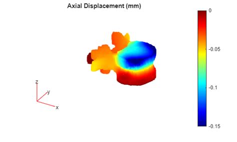 Medical Image Based Finite Element Analysis Of Spine