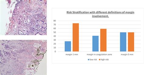 Resection Margin Involvement After Endoscopic Excision Of Malignant