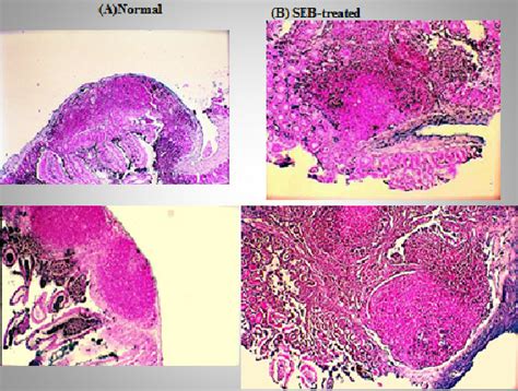 Staphylococcal Enterotoxin B Seb Induces Apoptosis In Mouse Peyers