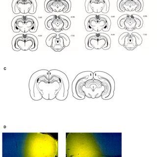 Location And Extent Of The Retrosplenial Cortex Lesions Experiments 1 Download Scientific