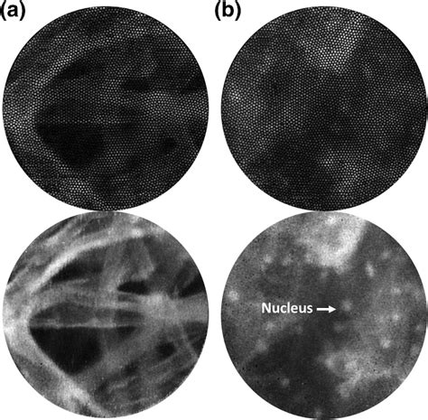 Snapshot Spectrally Encoded Fluorescence Imaging Through A Fiber Bundle