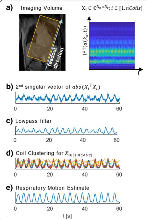 Data Driven Respiratory Motion Detection A Respiratory Motion Is Download Scientific Diagram