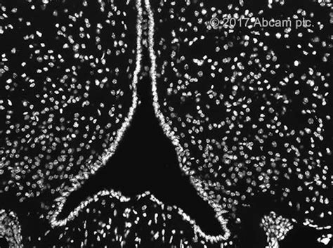 Mounting Medium With Dapi Aqueous Fluoroshield Ab104139 アブカム