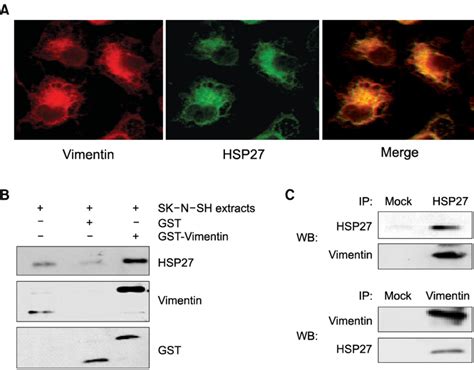 Hsp27 Interacts With Vimentin Both In Vivo And In Vitro A