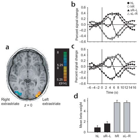 Transient Neural Activity In Human Parietal Cortex During Spatial Attention Shifts Nature