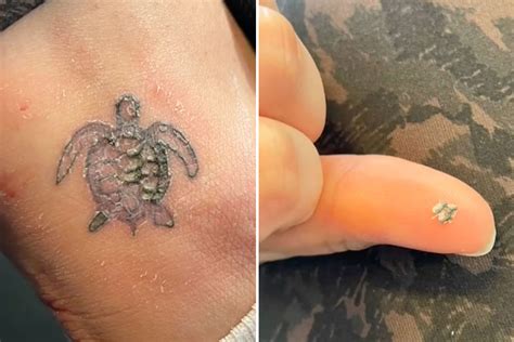 Peeling Tattoo Before And After