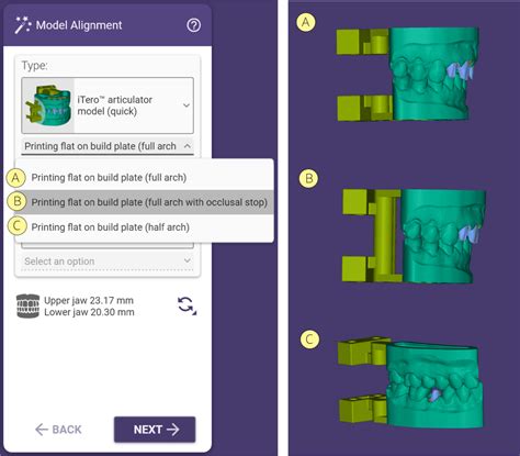 Model Creator Module Exocad