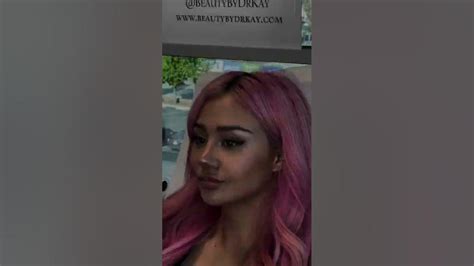 Have You Ever Heard Of Piriform Fossa Filler Youtube