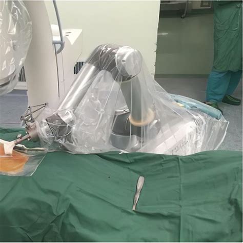 Pdf Effectiveness Of Tirobot Assisted Vertebroplasty In Treating Thoracolumbar Osteoporotic