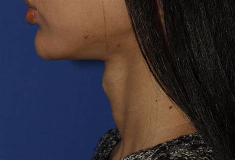 Adams Apple What Is It And Why Do We Have One Evrim Ağacı