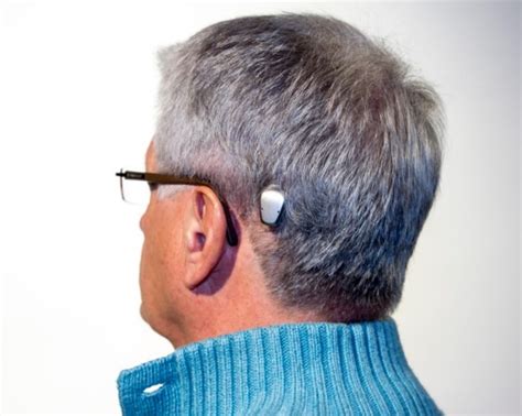 Bone Conduction Implant The Royal Victorian Eye And Ear Hospital