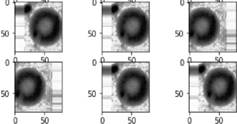 figure 1 from sickle cell anemia detection using convolutional neural