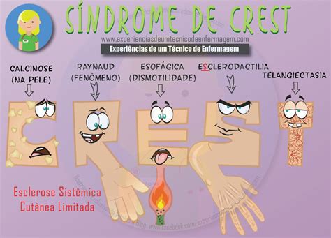 Enfermagem Ilustrada Via Síndrome De Crest