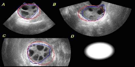 Figure 2 From Automatic Ovarian Follicle Quantification From 3d