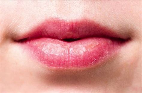 맘마랄라가가해보세요뇌졸증 초기증상 진단법 어썸클