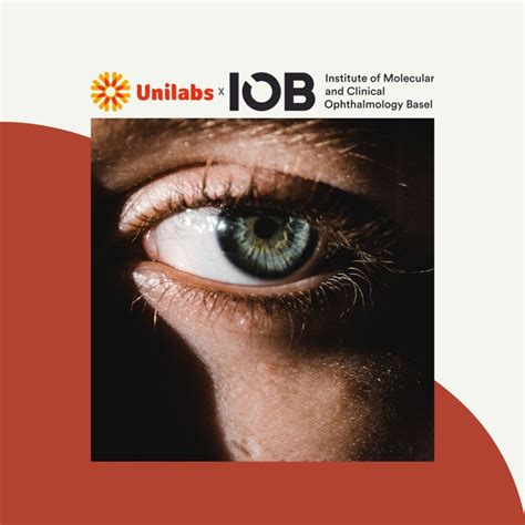 Institute Of Molecular And Clinical Ophthalmology Basel Iob On Linkedin Ophthalmology