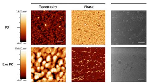 Residual Matrix From Different Separation Techniques Impacts Exosome