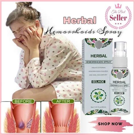 100 Effective Eelhoe Natural Herbal Hemorrhoids Spray Original Gamot