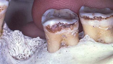 Strategies To Address Periodontally Involved Furcations Dimensions Of
