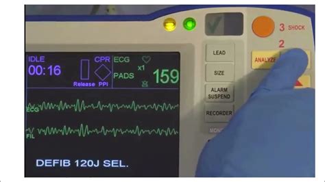 Zoll R Series Defibrillation Youtube