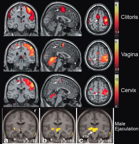 A Look At Orgasms During An MRI Scan Scrolller