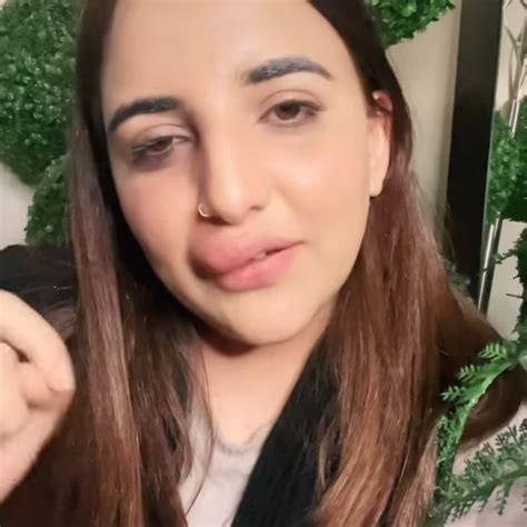 Pakistani Tiktok Star Gets Botched Lip Fillers In Viral Video Watch Here Atelier Yuwa Ciao Jp