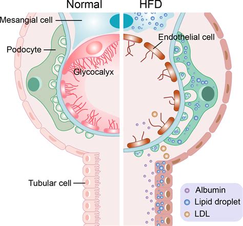 The Role Of Exercise In Improving Hyperlipidemia Renal Injuries Induced By A High Fat Diet A