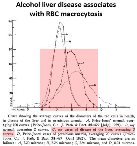 1🧵 Why Does Chronic Alcohol Use Cause Macrocytosis Alcohols Ability