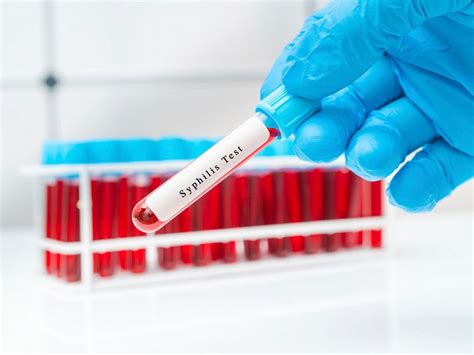 Бэлгийн замаар дамжих халдварт өвчний тохиолдол 42 хувиар буурчээ