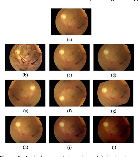 Figure 1 From Dual Branch Deep Learning Network For Detection And Stage Grading Of Diabetic